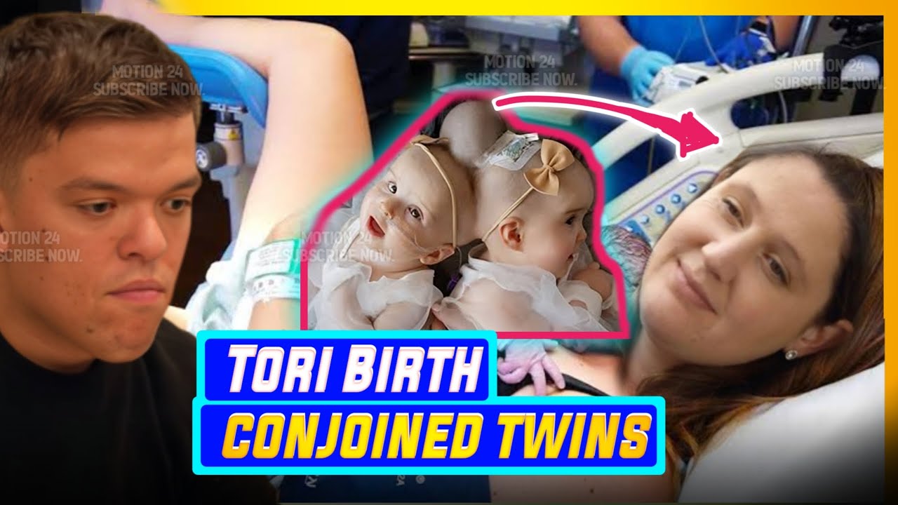 Today Tori Roloff Birth Conjoined Twins Baby | Zach, Amy Roloff Happy ...